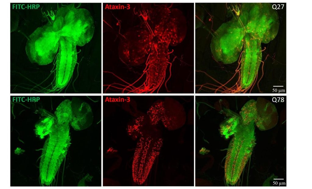 Upregulated Autophagy - Possible answer to SCA3 Motor Neuron Disorder ...