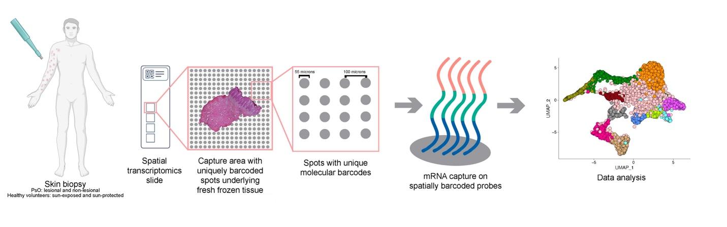 Decoding Psoriasis: Spatial Genomics Study - BioPatrika